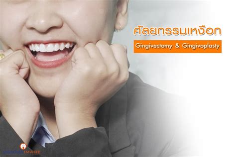 Dental Gingivectomy Dental Image Clinic