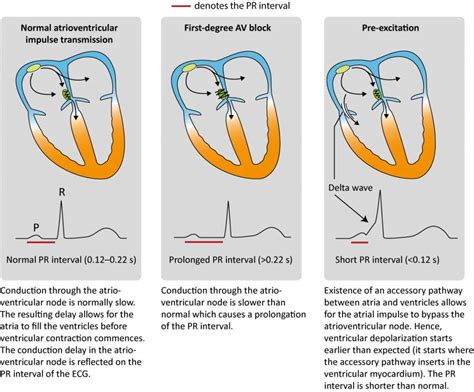 The Pr Interval And Pr Segment The Cardiovascular