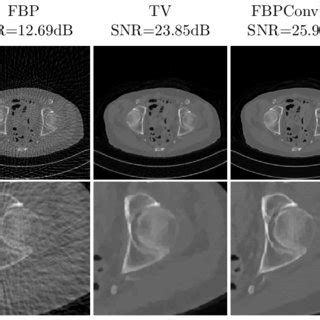 Pdf Deep Algorithm Unrolling For Biomedical Imaging