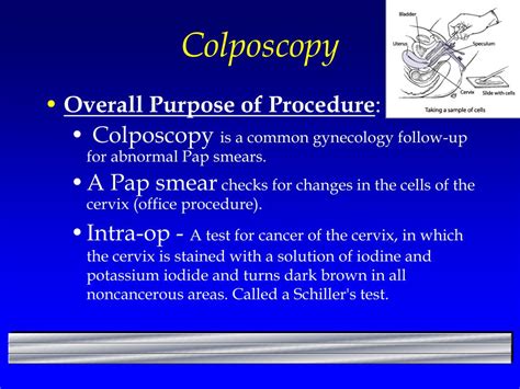 Ppt Colposcopy Powerpoint Presentation Free Download Id 1703513