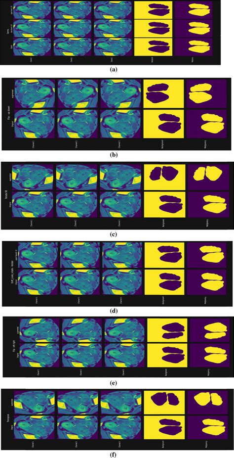 A Da By Gamma Correction B Da By Flip Left Right C Da By Flip Up Download Scientific Diagram