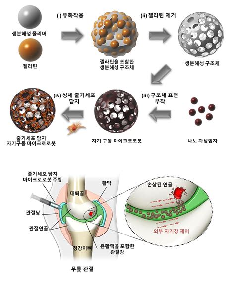 마이크로로봇 이용 자가골수줄기세포치료술 개발한다