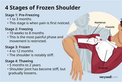 Frozen Shoulder Massage Therapy Frozen Shoulder Treatment