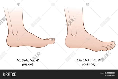 Medial Side