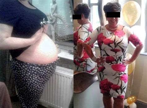 Uterine Fibroids No More Fibroids Miracle Reviews Pros Cons And How It Works