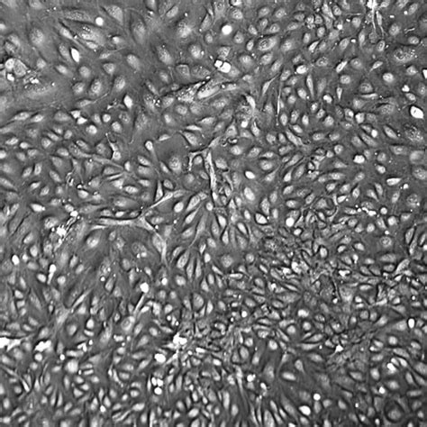 Human Primary Endothelial Cells