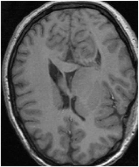 Grdview Has Troubles With Images Not Inrgb · Issue 6908