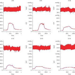 Erectile Response As Indicated By The ICP MAP Ratio A Representative Download Scientific