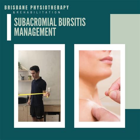 Subacromial Bursitis Physiotherapy Management Brisbane Physiotherapy