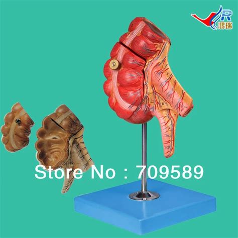 Iso Anatomical Model Of Appendix And Caecum Human Appendix In Medical