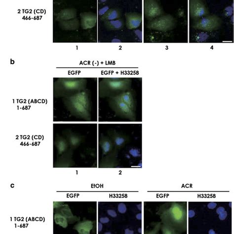 Domain Structure Of Human Tg2 Schematic Diagram Of Egfp Tagged Human Download Scientific
