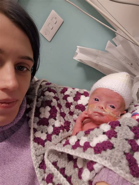 Le Dijeron Que Su Bebé Había Muerto En El Vientre Y Nació 4 Semanas