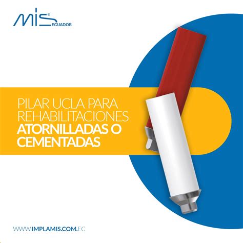 Las Uclas Son Pilares Implantes Dentales Mis Ecuador Facebook