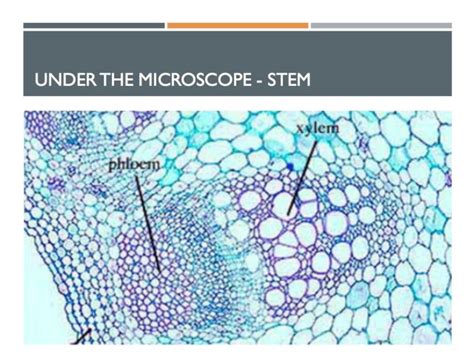 Xylem And Phloem Microscope Hd