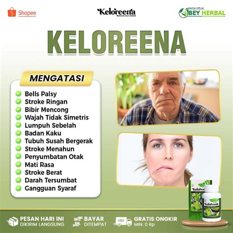 Jual Obat Bells Palsy Stroke Ringan Bibir Mencong Wajah Tidak