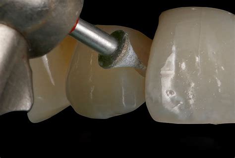 Clinical Case 21st Century Class Iii Solventum