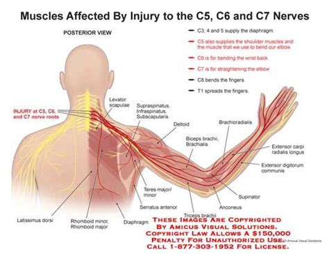 1312803x Muscles Affected By Injury To The C5 C6 And C7 Nerves