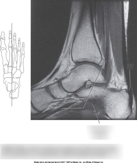 Ct Knee 2 Diagram Quizlet