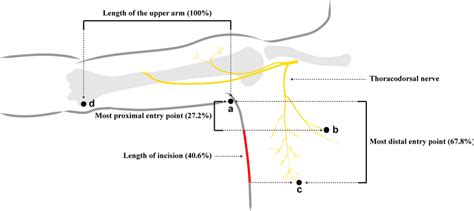 Optimal Incision Length And Range Of Hyperselective Neurectomy Of
