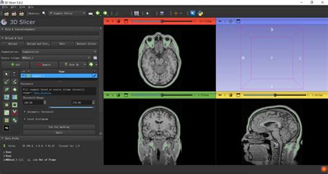 How To Modify The Default Threshold Values In Segment Editor For Custom Segmentation Support