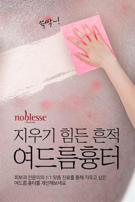 노블레스피부과 대인관계의 위축 성격 변화 장기간 스트레스로 이어지는 여드름흉터😔 여드름이 Facebook