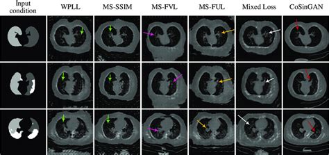 Comparison Of Synthetic Radiological Images With Image Size Of 256 ×