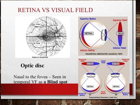 Visual Field Testing And Interpretation
