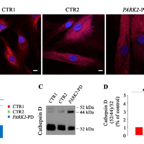Alterations Of Lysosomal Activity In Park2 Pd Cells A B Cells Were