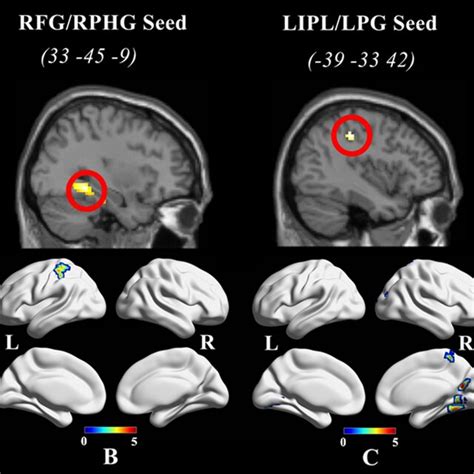 Significant Increases In Seed Based Functional Connectivity In Download Scientific Diagram
