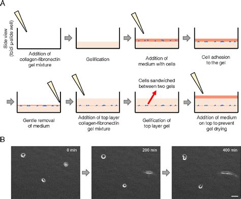 Figure 1 From Analysis Of Random Migration Of Cancer Cells In 3d