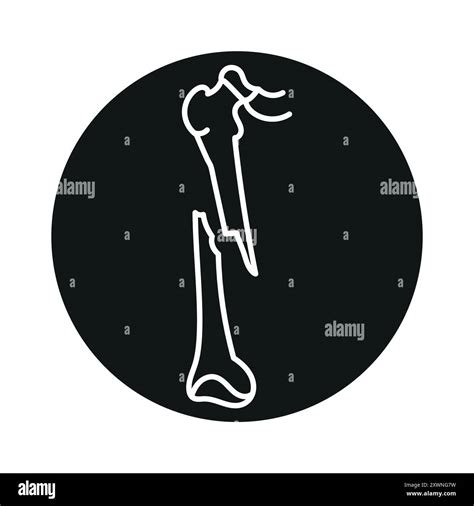 Femoral Fracture Line Black Icon Sign For Web Page Mobile App Button Logo Vector Isolated