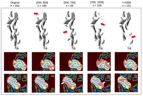 deletion benchmarks visualization of original sulcal pattern and its
