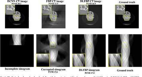 Figure 10 From A Deep Learning Reconstruction Framework For X Ray Computed Tomography With