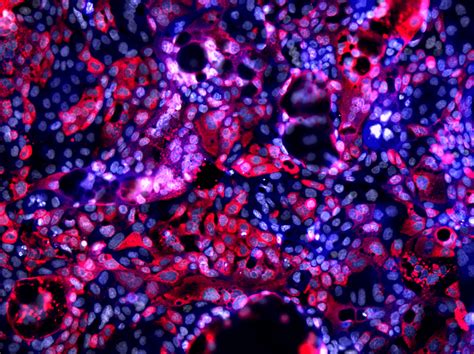 Viral Spread Quantification