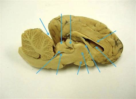 Sheep Brain Diagram Quizlet