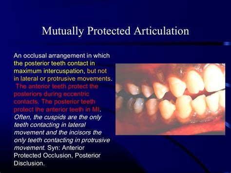 Occlusion2