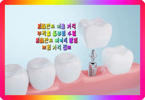 임플란트 비용 가격 부작용 종류별 수명 및 임플란트 뼈이식 보험 가격 정보