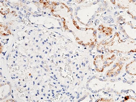 Acox1 Polyclonal Antibody Pa5 80301