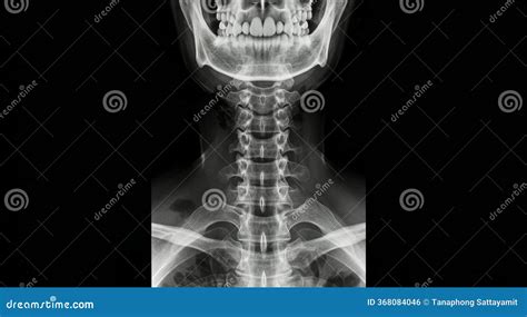 Human Vertebrae Diagram Infographics Vector Illustration