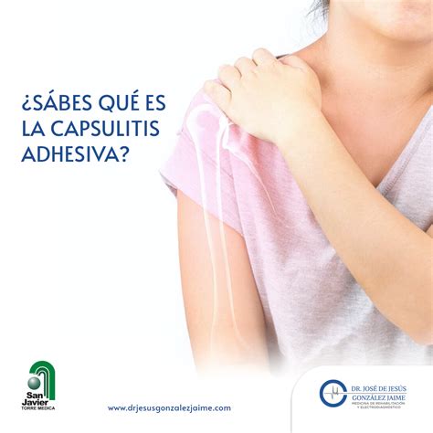 La Capsulitis Adhesiva También Dr Jesús González Jaime