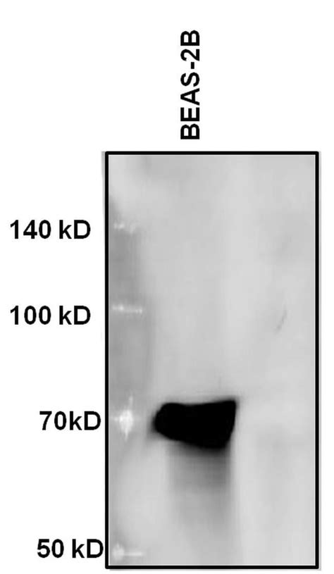 P53 Monoclonal Antibody Pab 240 Invitrogen™ 100 μg Unconjugated