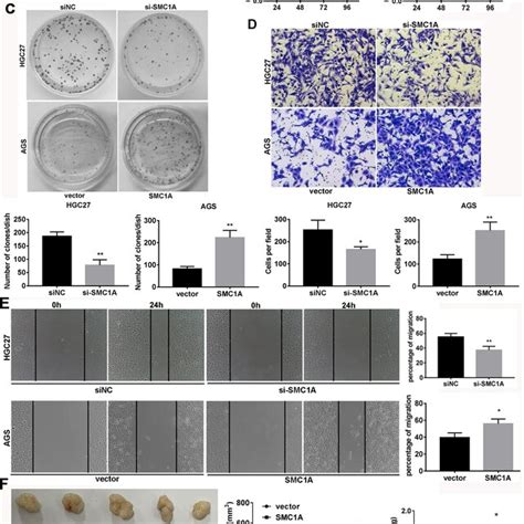 Smc1a Promoted Gastric Cancer Cell Proliferation Invasion And