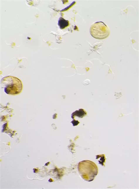 Plankton Tow Wyeth Lab