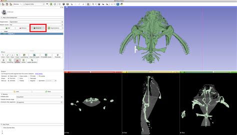 3d Slicer Segmentation Roi