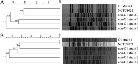Dendrograms Of PFGE Fingerprint Patterns For V Cholerae Following