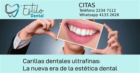 Carillas dentales ultrafinas La nueva era de la estética dental