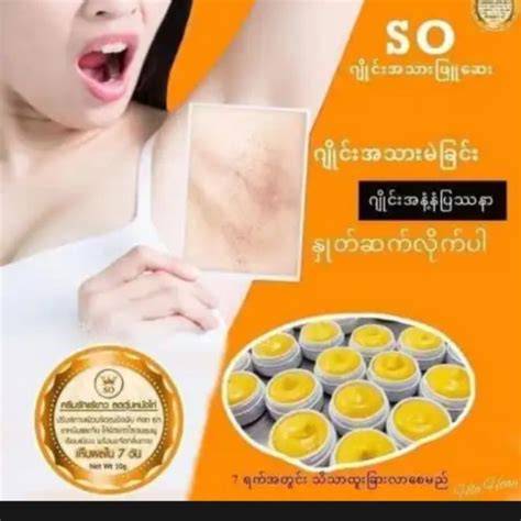 So ဂျိုင်းဖြူဆေး Cream Lazada