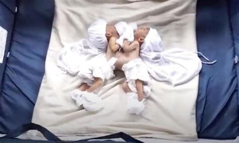 Kmjs Magkadikit Na Dibdib Ng Kambal May Kinalaman Nga Ba Sa Lihi At