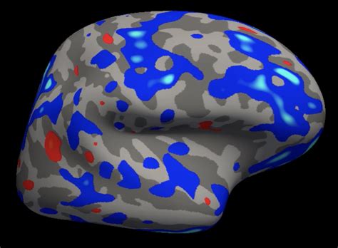 Freesurfer Tutorial 7 The Fsgd File — Andys Brain Book 10 Documentation