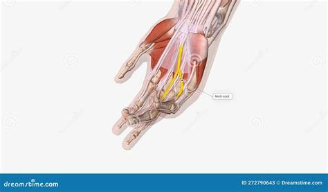 Fibrotic Tissue And Collagen May Accumulate In The Mottled Central